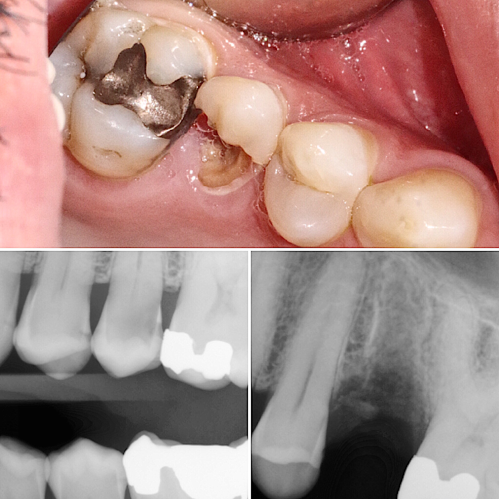 Dental Surgery and Sedation